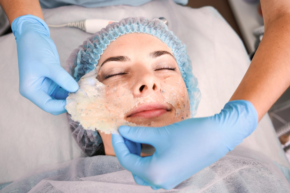 Different type of Chemical Peels - Maysdermatology